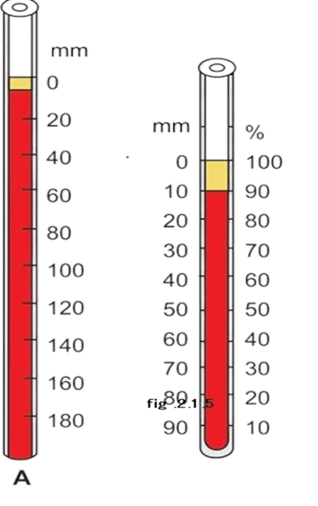 Wintrobe and Westergren Tubes: Types, Uses, and Differences in ESR ...