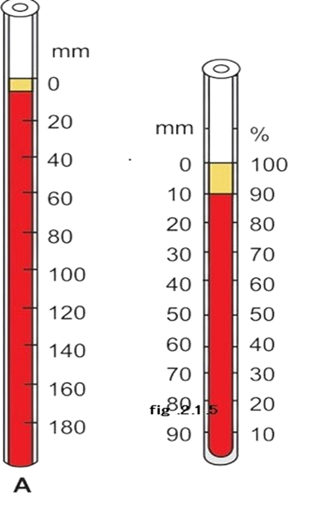 Wintrobe and Westergren Tubes: Types, Uses, and Differences in ESR ...
